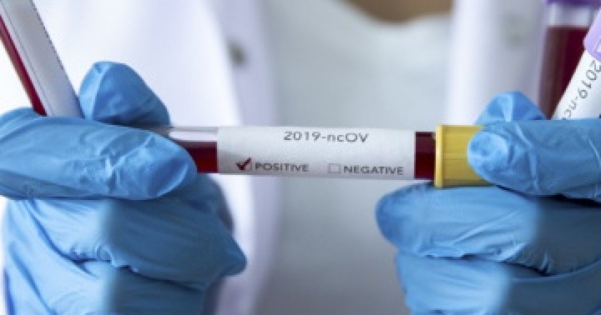 В Донецкой области обнаружено 32 новых случая covid-19 — Karachun